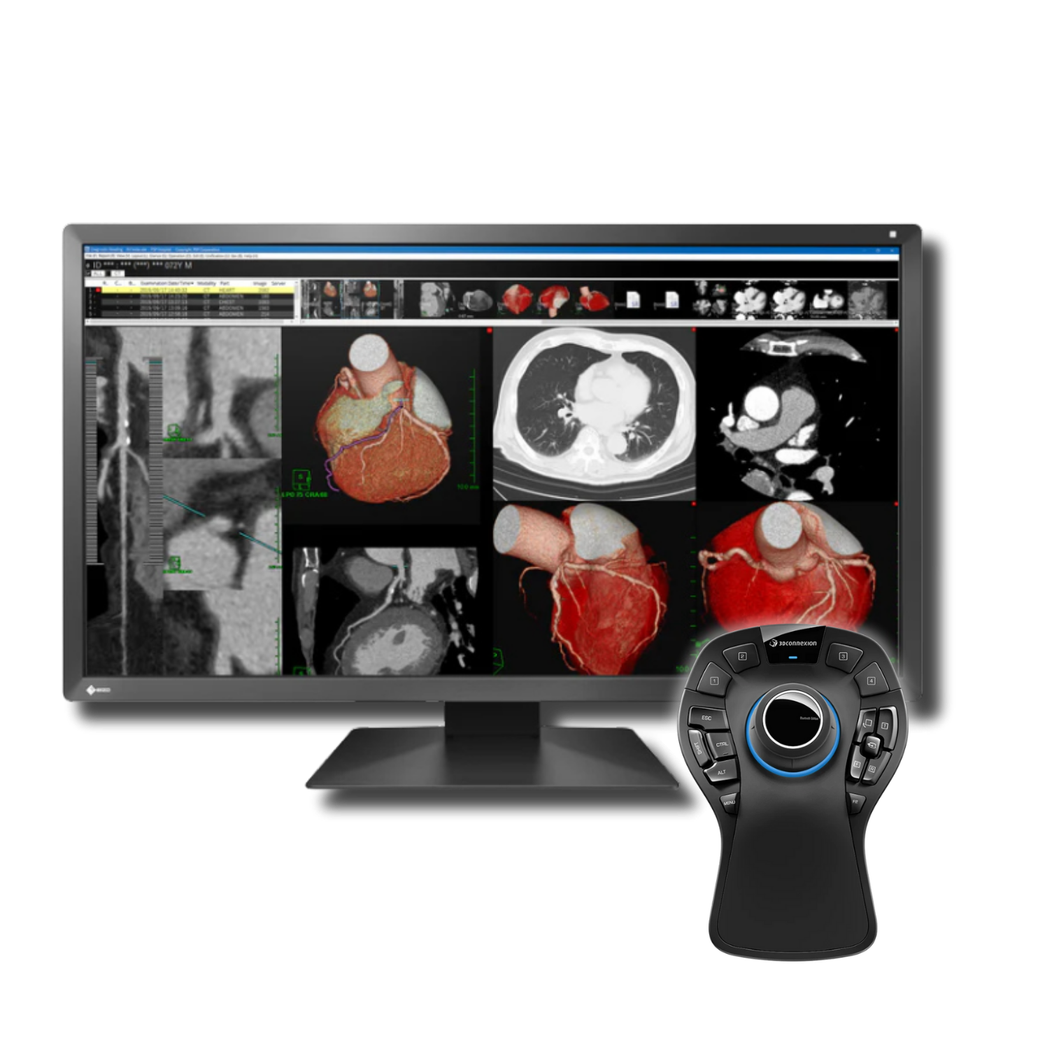 EIZO | RadiForce | MX317 + SpaceMouse Pro | Poste de lecture